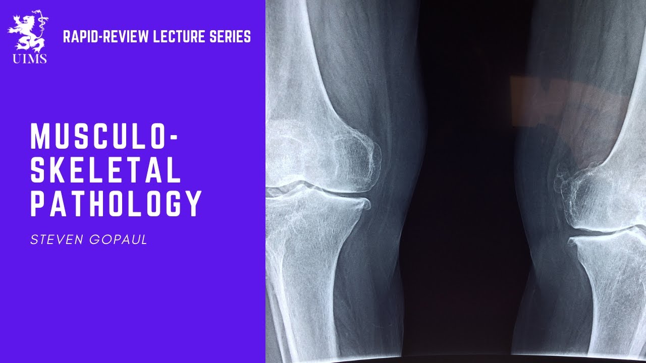 Musculoskeletal Pathology - Steven Gopaul - YouTube