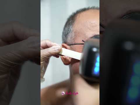 Erkek Buz Lazer Epilasyon | Lila Life Türkiye’nin Kurumsal Güzellik Merkezleri   #lazerepilasyon