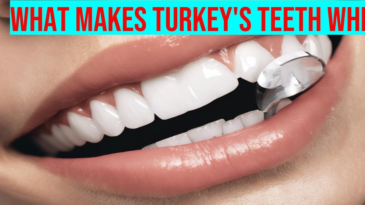 Affordable Teeth Whitening: Turkey's Competitive Advantage - How Does ...