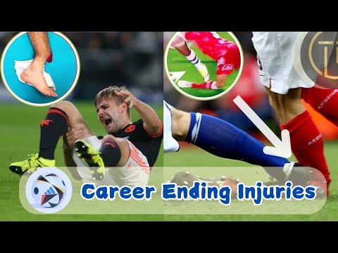 Top 10 Most Devastating Career-Ending Injuries in Football History ...