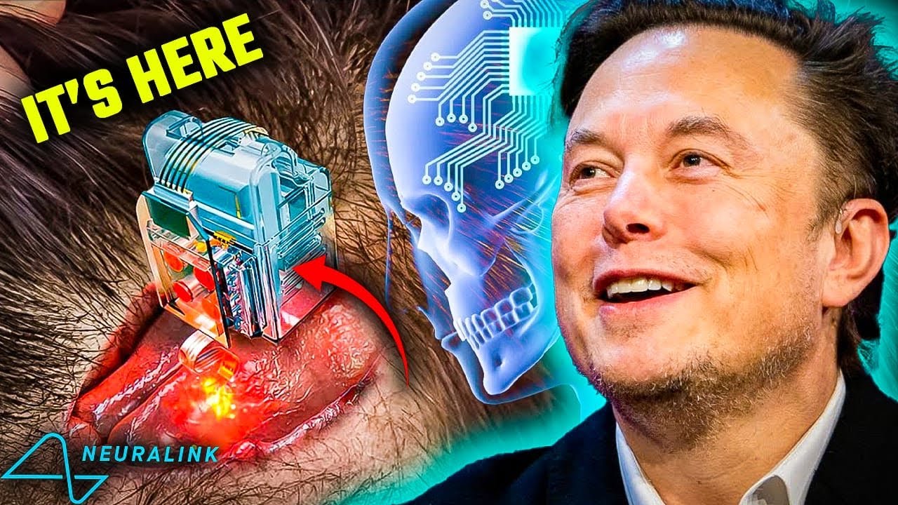 What Is Neuralink And How Does It Work Explained Youtube