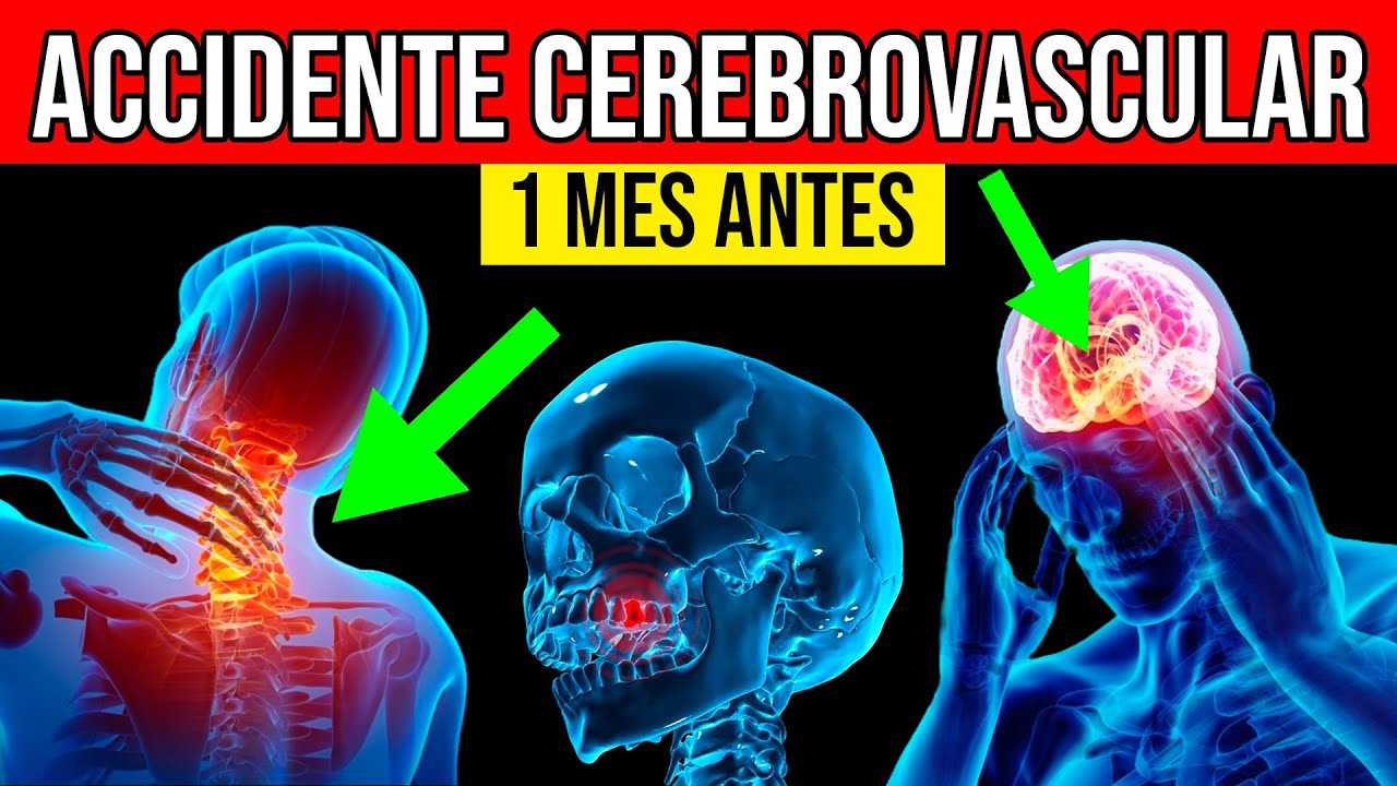 7 SEÑALES DE ADVERTENCIA 1 MES ANTES de que Ocurra UN ACV | ICTUS ...