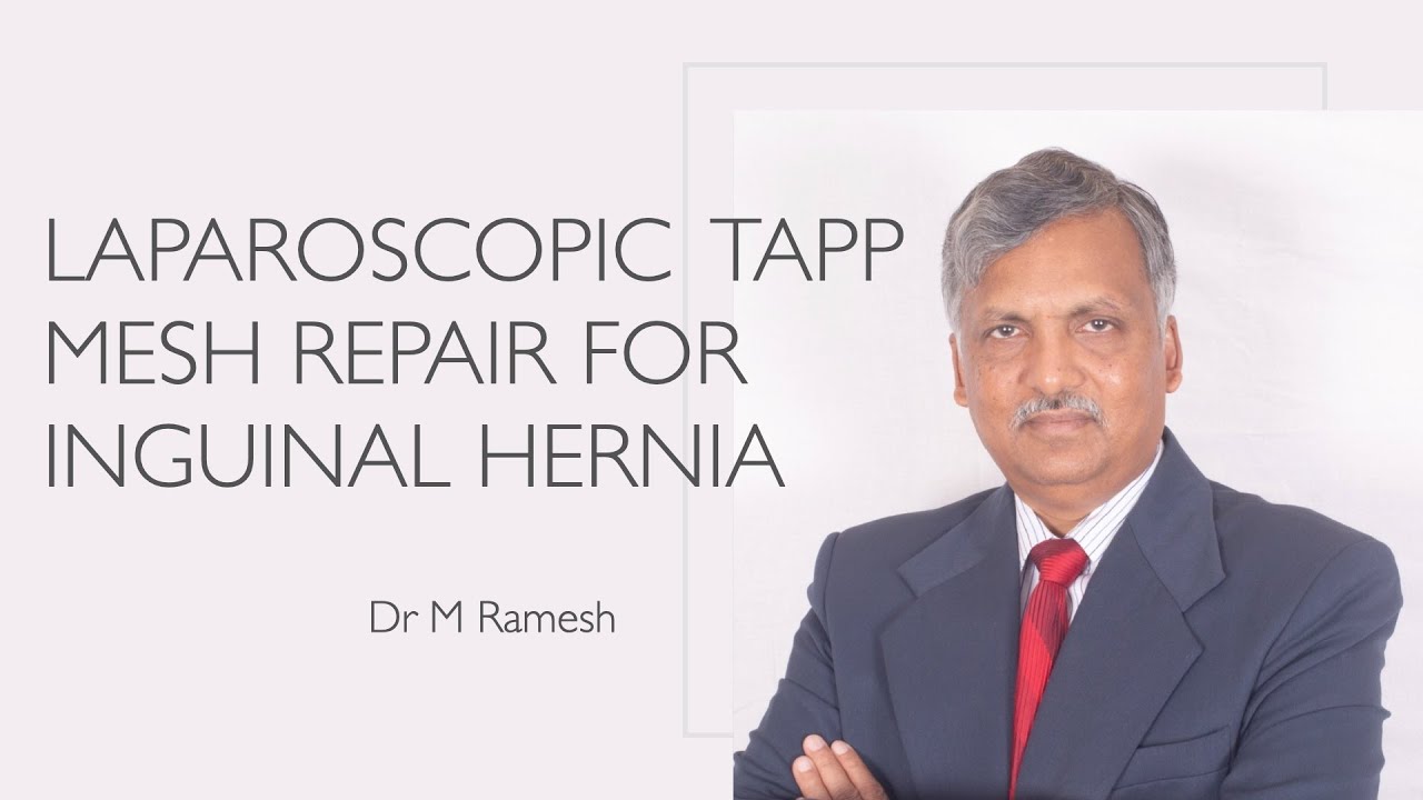 TAPP for Inguinal Hernia - Dr M Ramesh (with voice over and ...