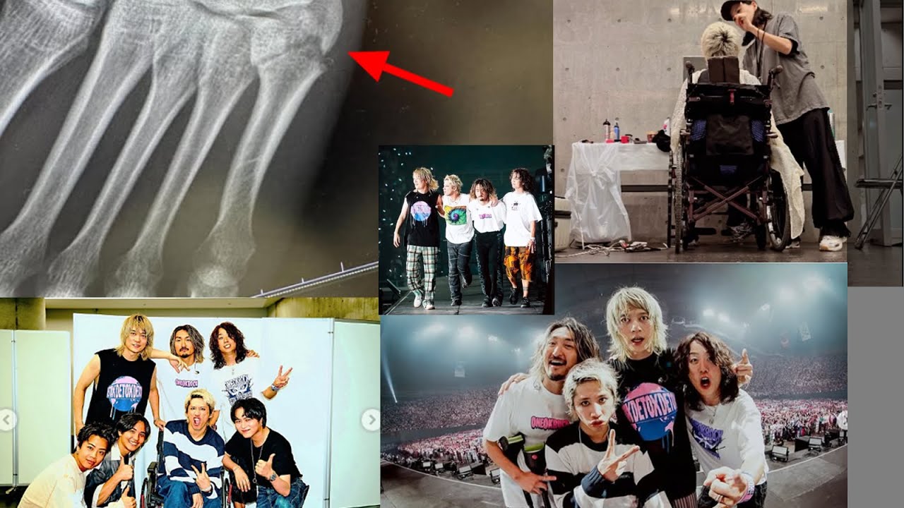 IG LIVE Trad: Taka se Rompe el 5.º Metatarsiano en el Nissan Stadium ...