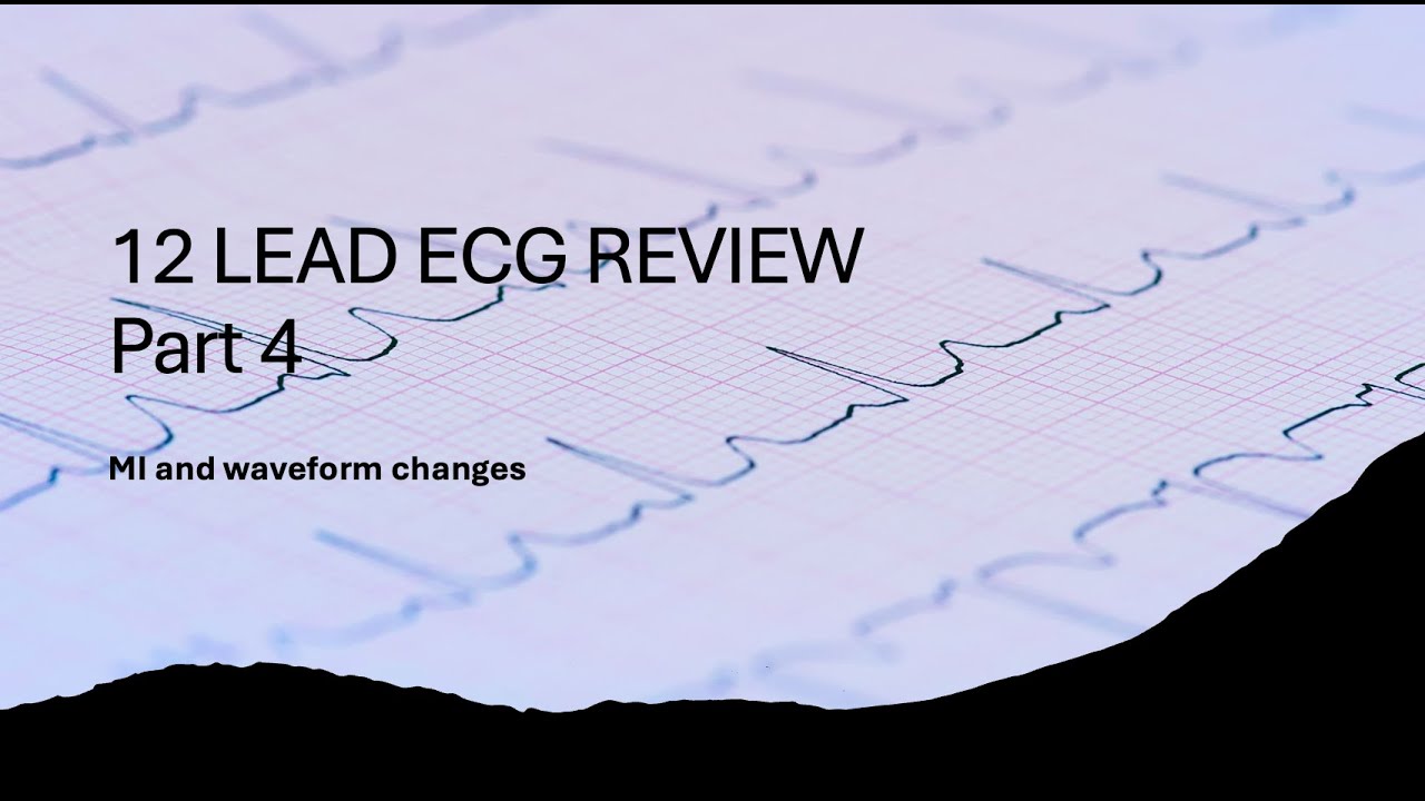 12 Lead Review Part 4- MI and Waveform Changes - YouTube