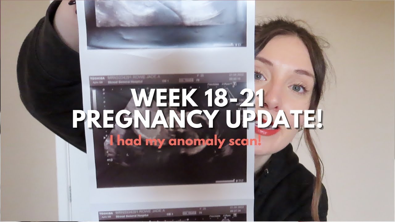 Weeks 18-21 Pregnancy update🤰 | I had my anomaly scan 👶 | Boy or girl ...