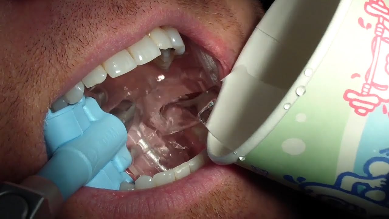 EZ DAM suction demonstration - YouTube