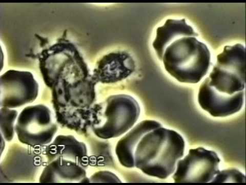 Humoral Pathology - YouTube
