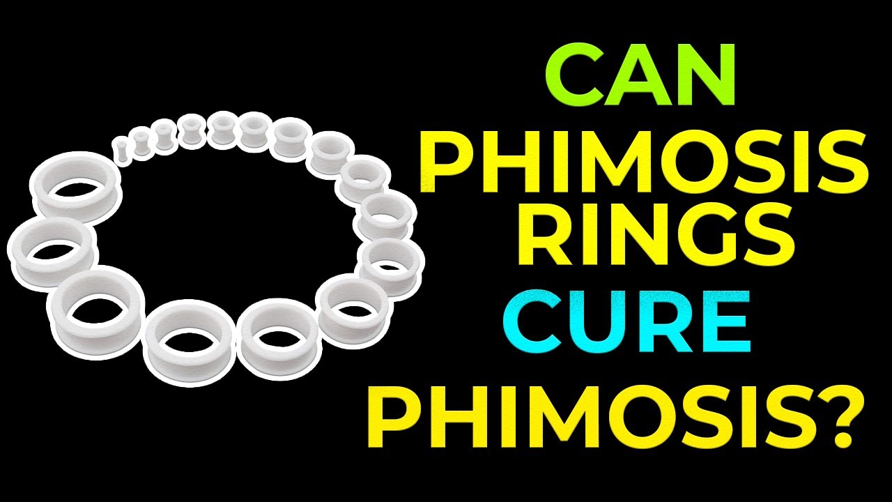 Can PHIMOSIS RINGS rings prevent REOCCURENCE of PHIMOSIS - YouTube