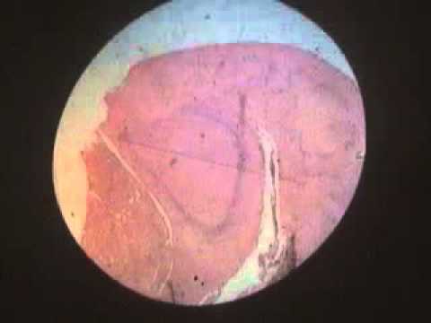 Cerebrum microscope - YouTube