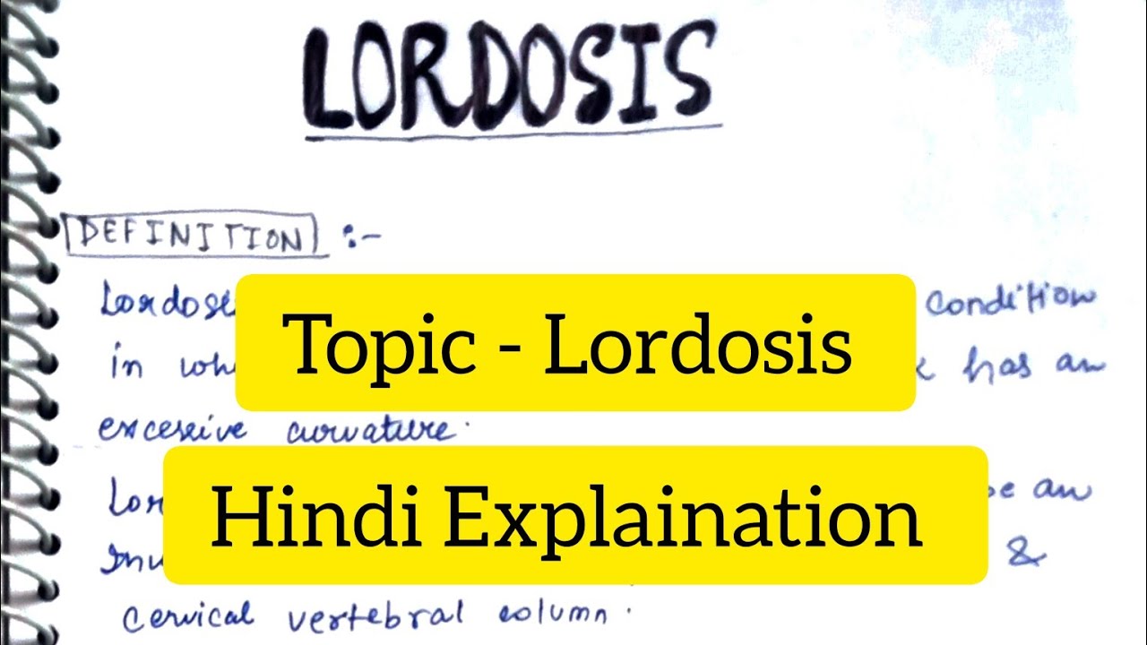 Lordosis | Definition | Causes | Signs & Symptoms | Diagnosis ...