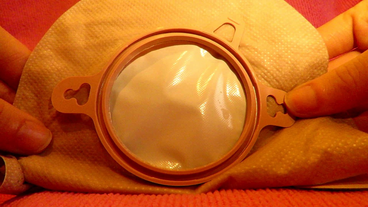 Quickly Change Your Ostomy YouTube quickly-change-your-ostomy-youtube