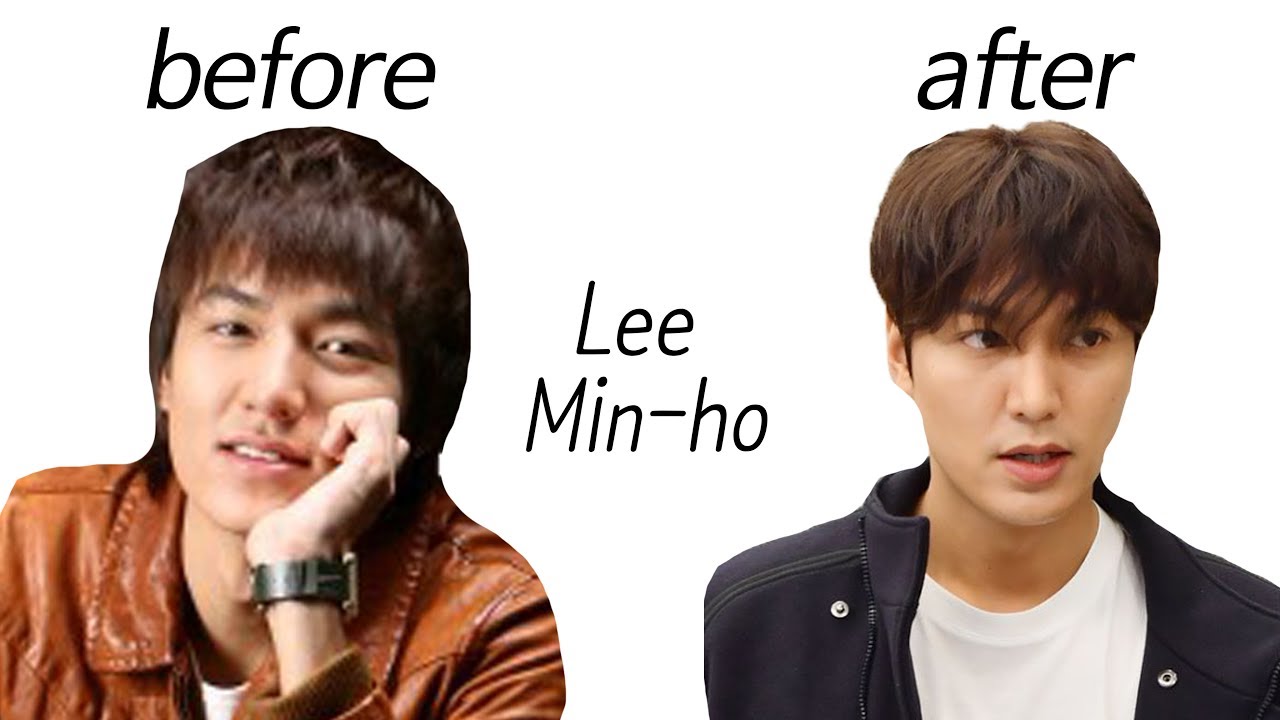 Lee Min Ho Before And After