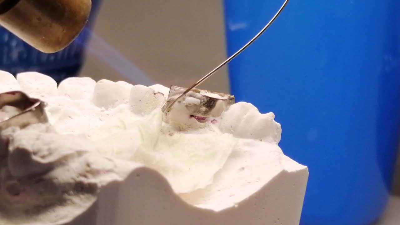 🔥Como SOLDAR una banda de ortodoncia EXTRUIDA - YouTube