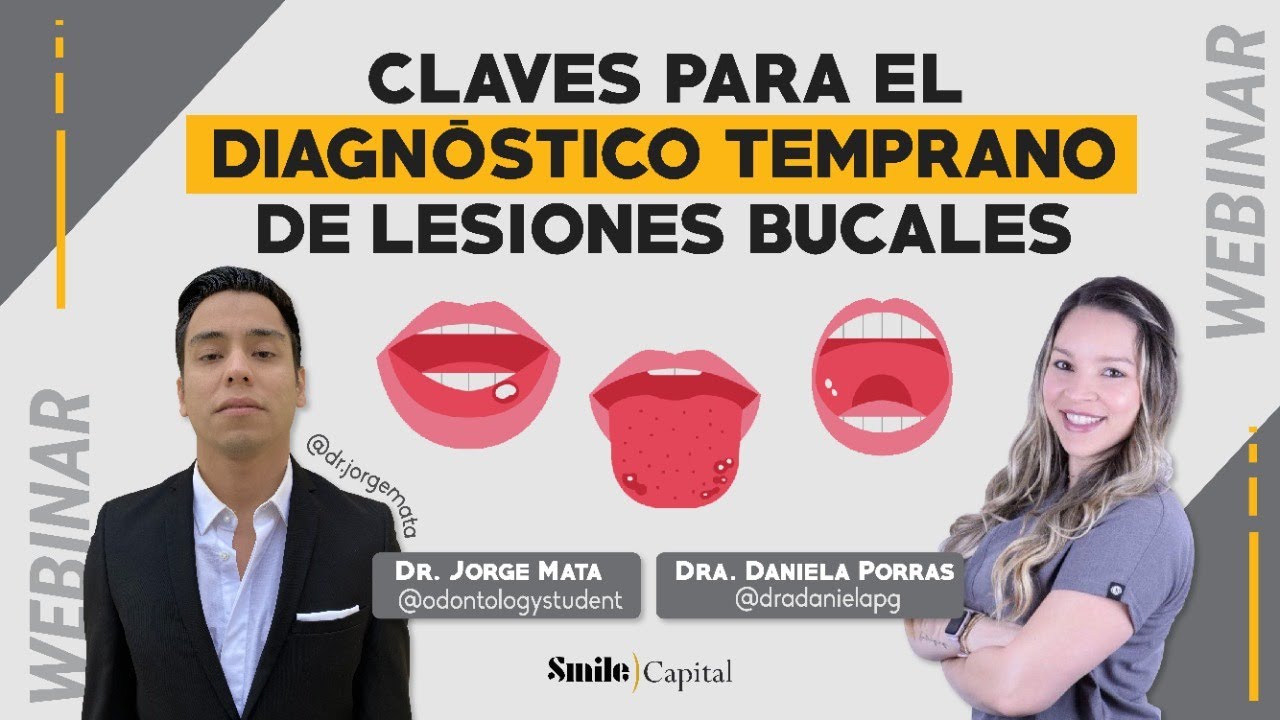 Claves para el Diagnóstico Temprano de Lesiones Bucales - Dra. Daniela Porras & Dr. Jorge Mata ...