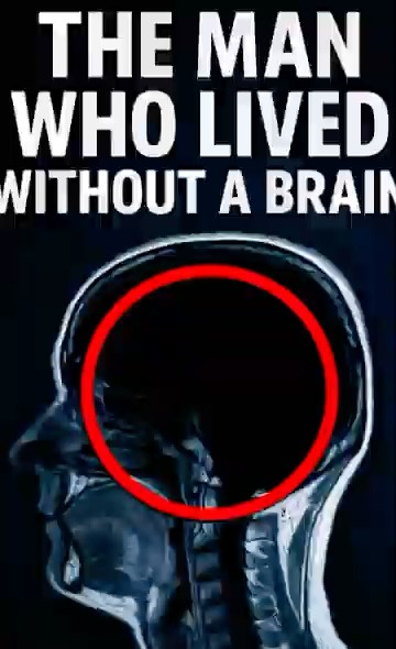 #storytime#mystery 🧠 The Man Who Lived Without a Brain 😱 | Shocking ...
