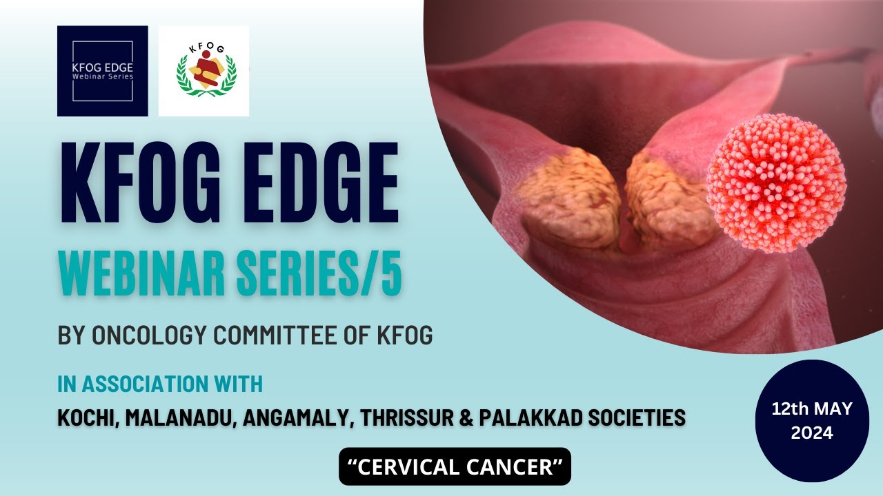 KFOG EDGE WEBINAR SERIES - EPISODE 5 - YouTube