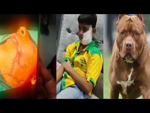 Small Boy Escapes from 3 Angry Dogs 😯1080p | How 2 Escape Its Very Hard ...