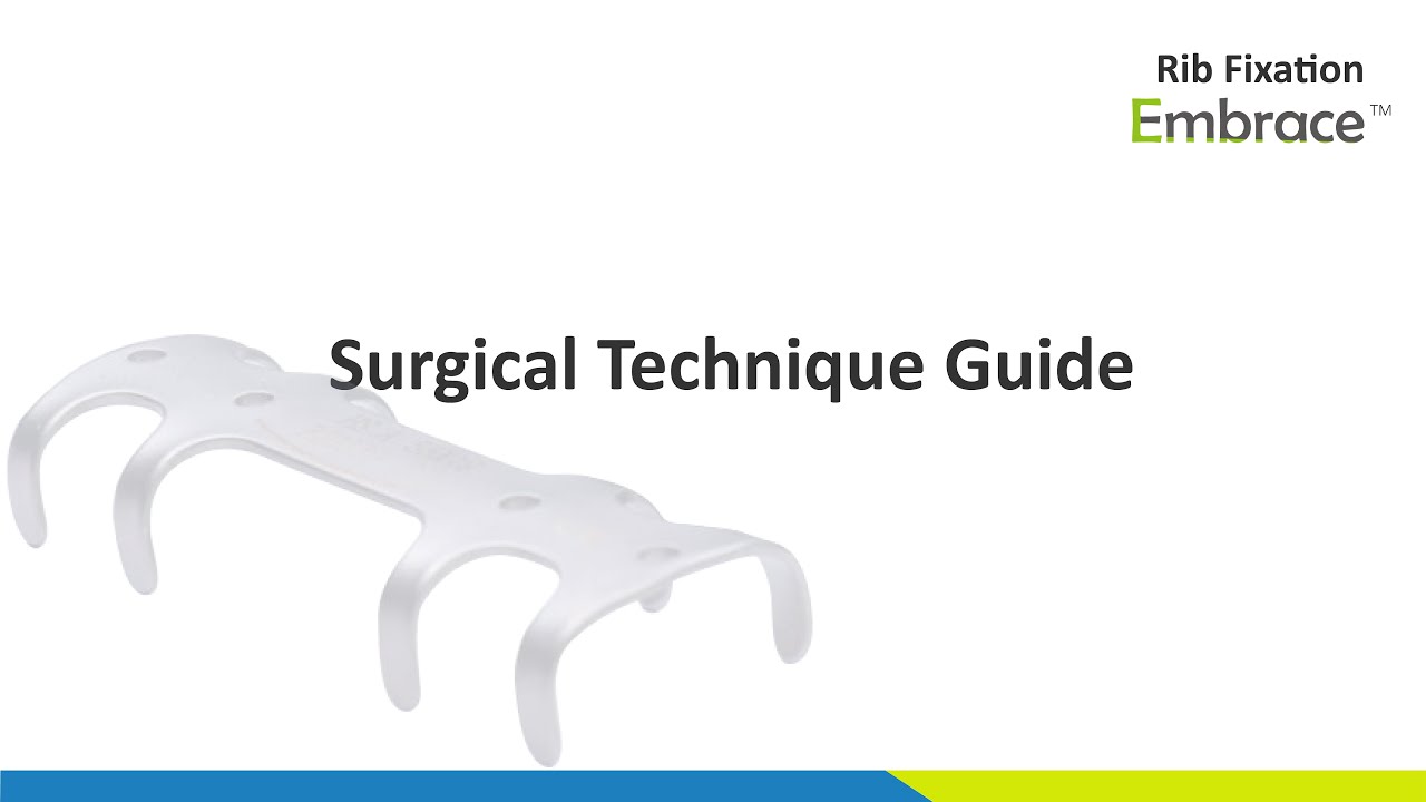 Embrace Rib Fixation - YouTube