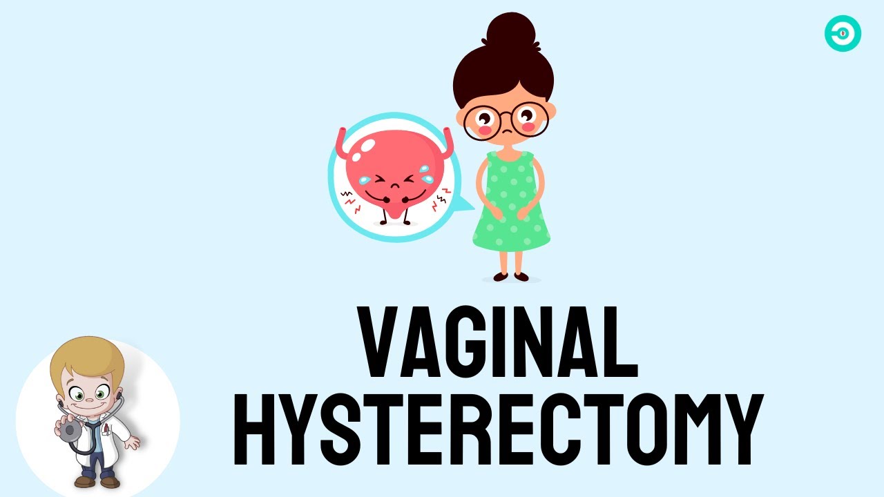 Vaginal Hysterectomy: what is it and how its done? - YouTube