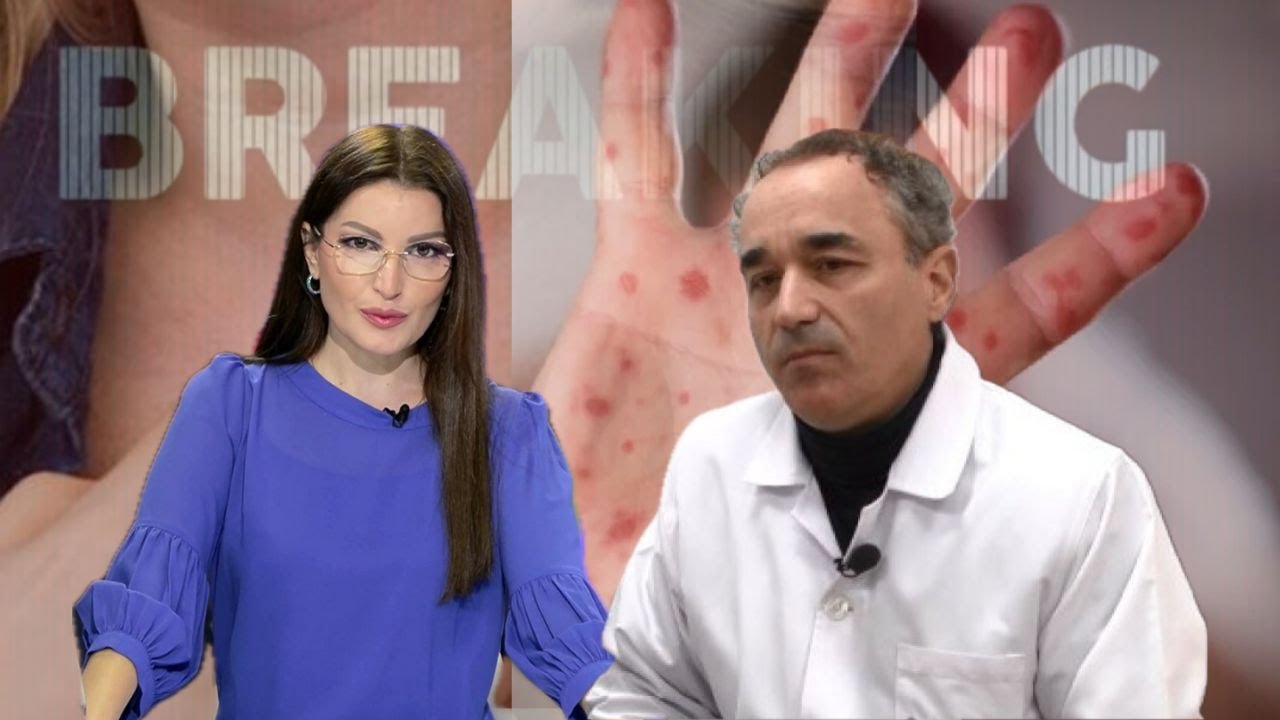 Zgjebe apo alergji/ Mjeku: Ja si t'i dallojmë | Breaking - YouTube