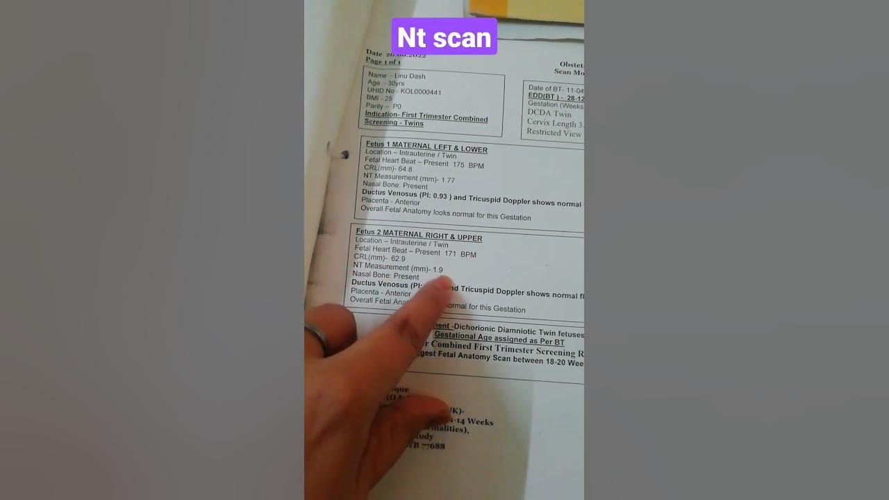 Nt scan report / NT scan #shorts #shortsvideo #viralvideo - YouTube