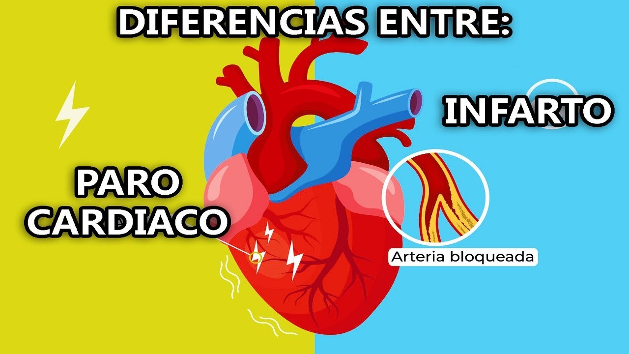 🔴 DIFERENCIAS ENTRE INFARTO Y PARO CARDIACO - YouTube