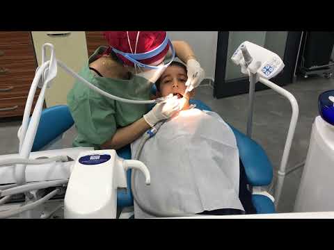 Çocuklarda diş tedavisi; dolgu ve kanal tedavisi yapımı.