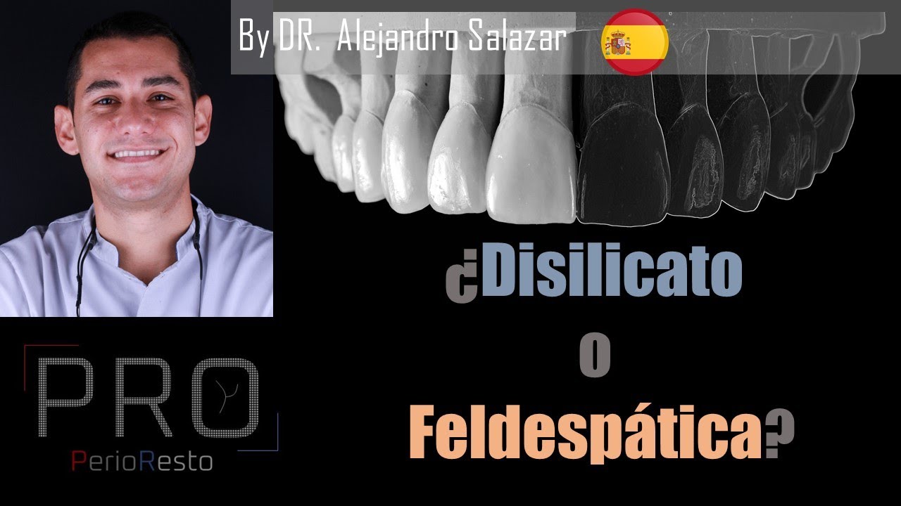 ¿DISILICATO O FELDESPATICA? cual es el MEJOR MATERIAL para nuestras ...