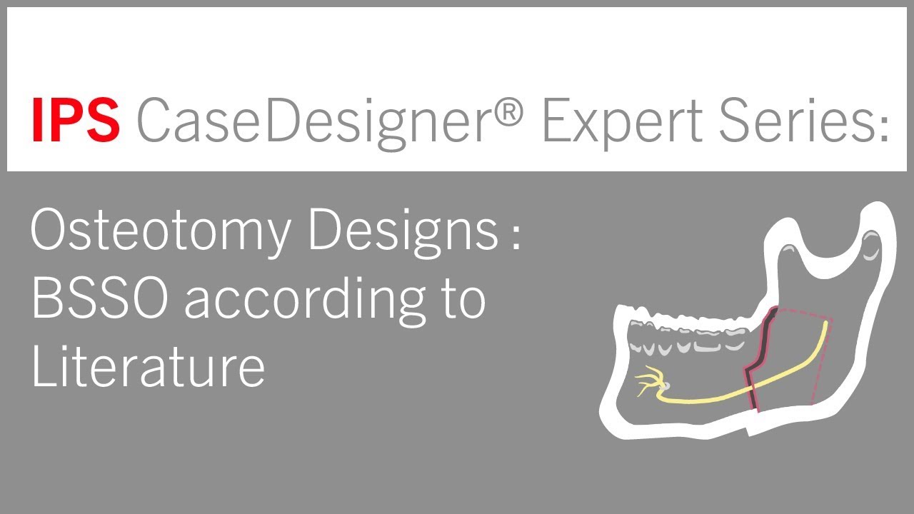 Osteotomy Designs | BSSO According To Literature | IPS CaseDesigner ...