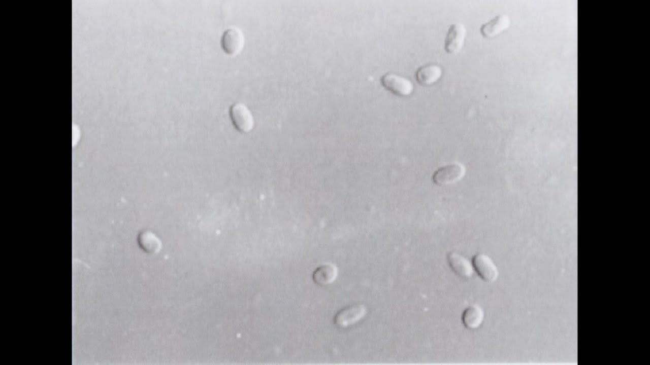 Preparing a Nosema Microscope Slide for analysis - YouTube