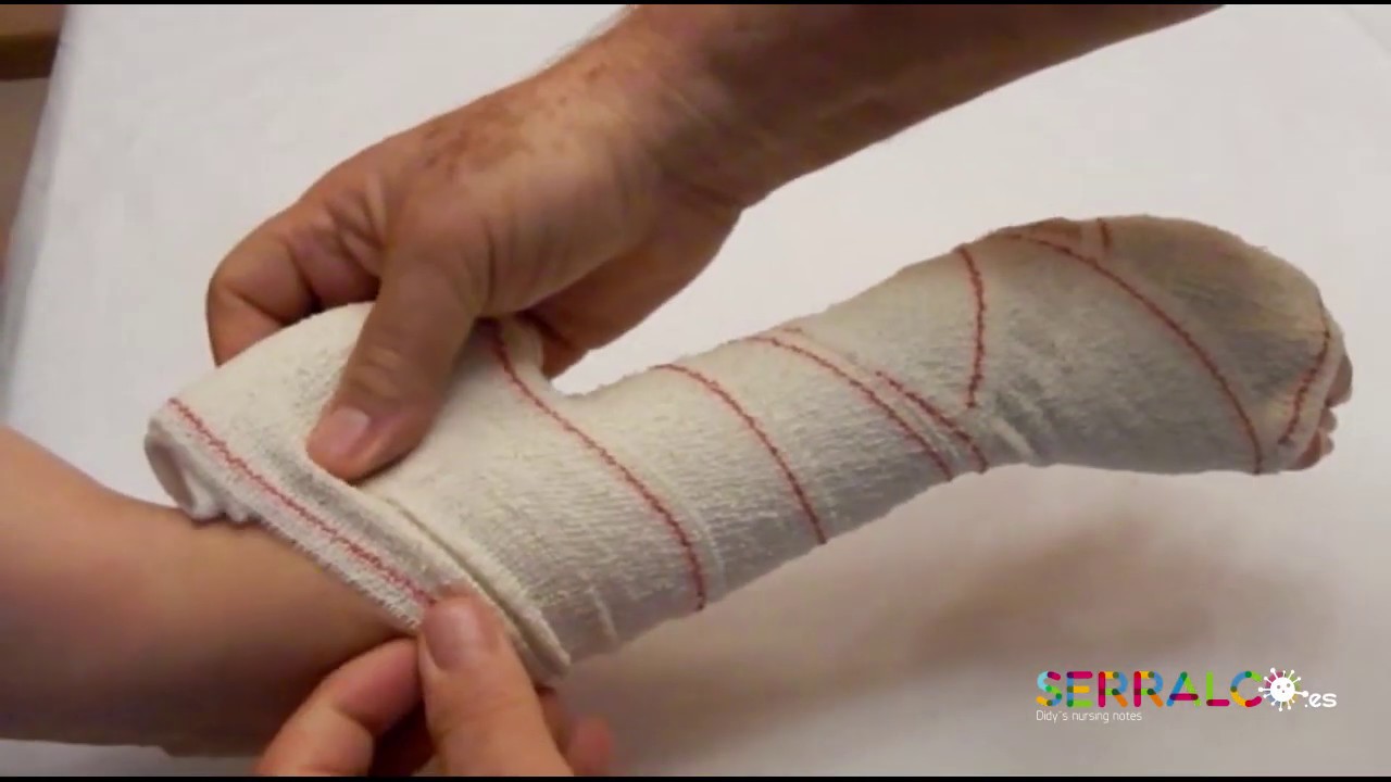 Tipos de Vendajes | Cómo hacer un vendaje de Espiral Invertida - YouTube