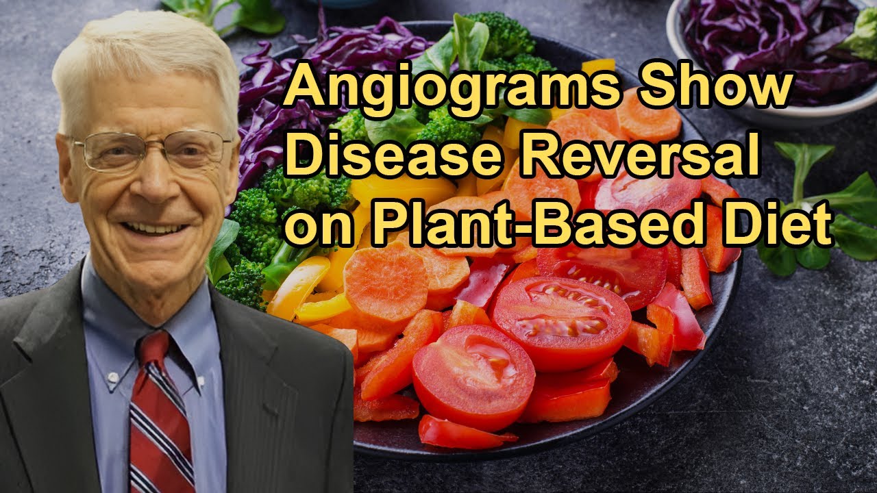 Angiogram Evidence of Disease Reversal on Plant-Based Diet - YouTube