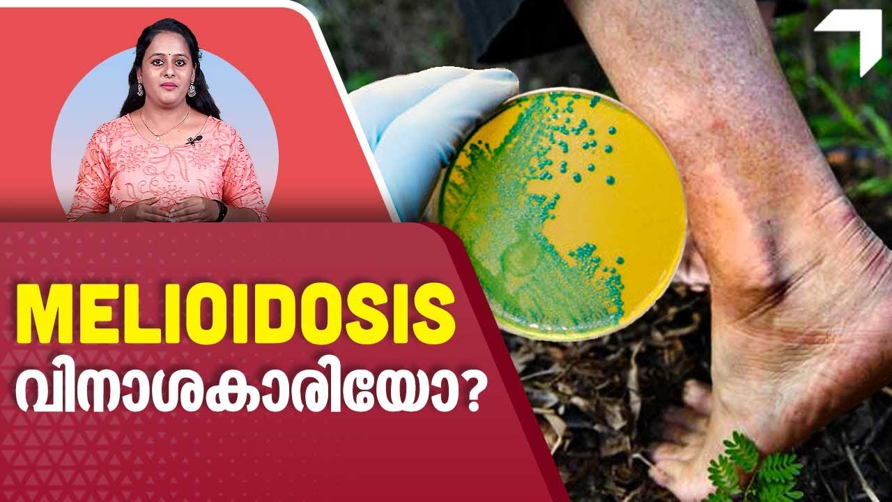 മെലിയോഡോസിസ് രോഗം വിനാശകാരിയോ? | Melioidosis Disease | Kerala - YouTube