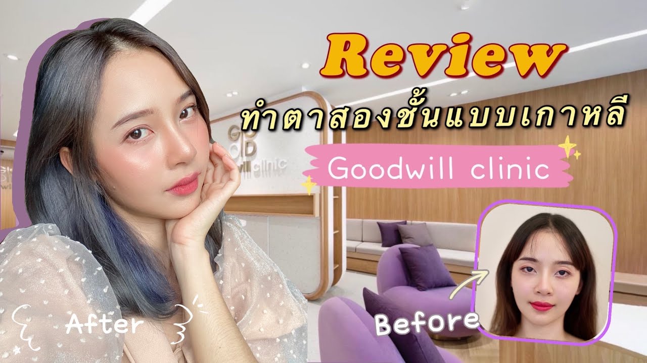แชร์ประสบการณ์ทำตาสองชั้นครั้งแรกที่ Goodwill Clinic - YouTube