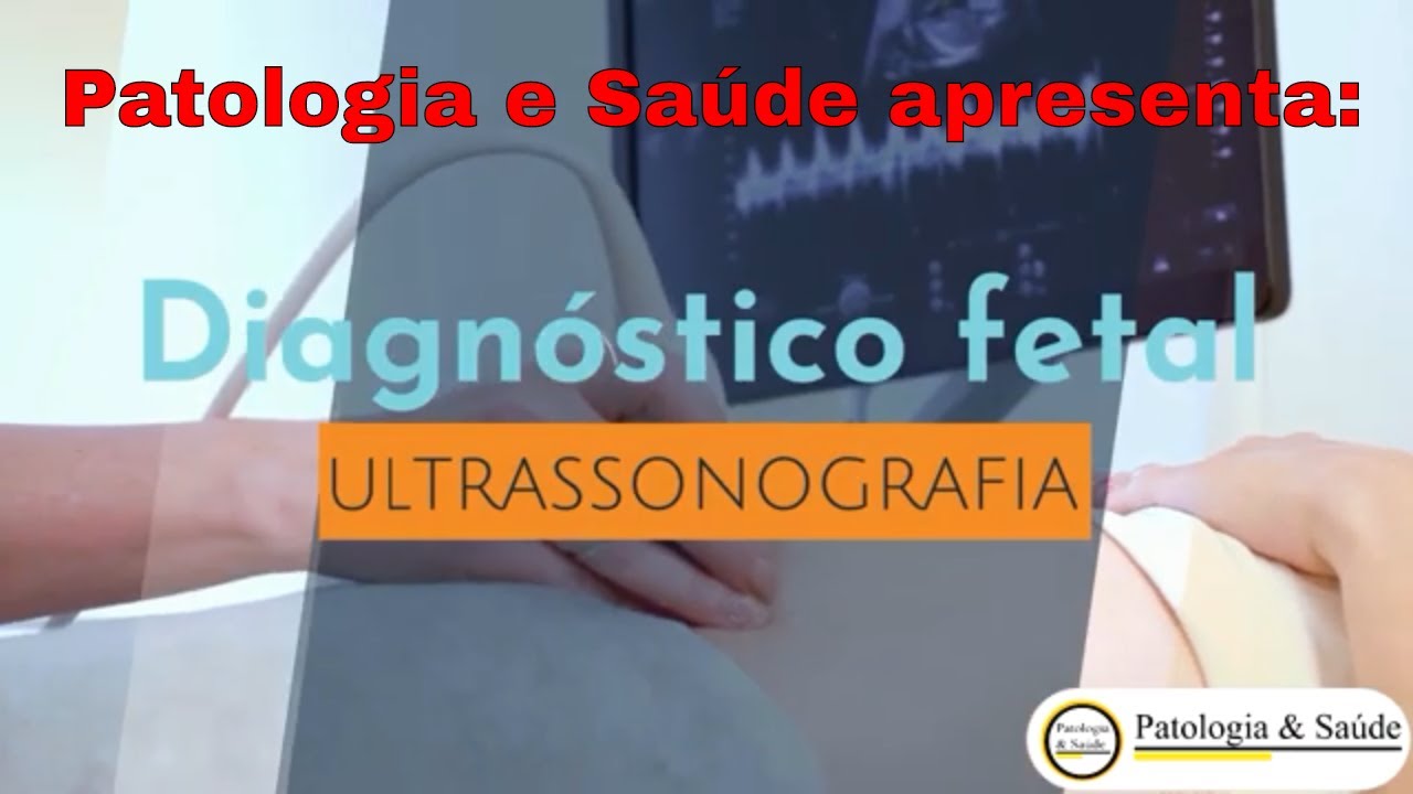 Ultrassonografia no diagnóstico fetal: como funciona e para que serve ...