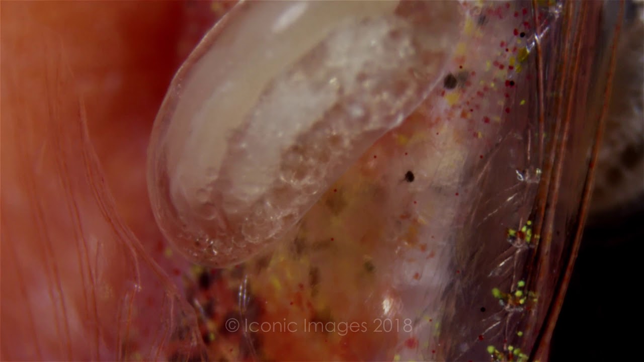 Parasites living on fish (Copepod Parasite on a whip coral goby) - YouTube
