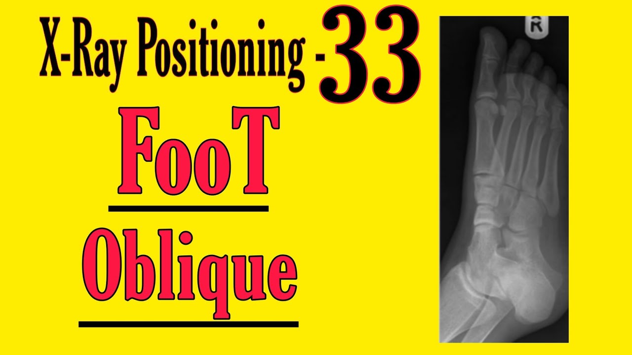 FOOT OBLIQUE POSITIONING HINDI | X RAY POSITIONING FOR RADIOGRAPHERS ...