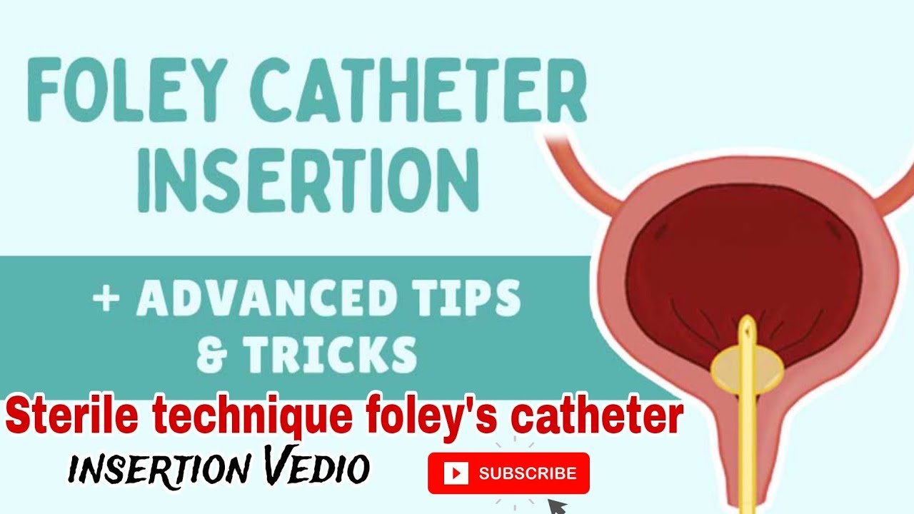 Sterile technique foley's catheter insertion || Foley's catheter ...
