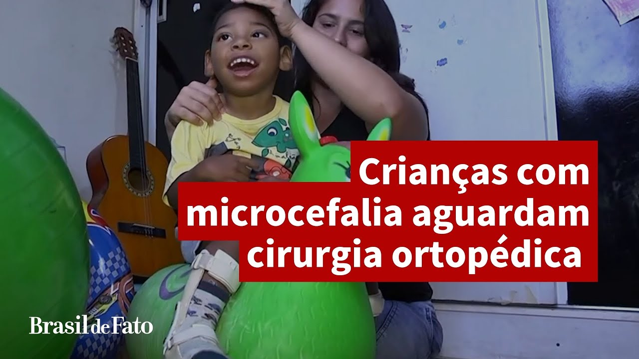 Crianças com microcefalia aguardam cirurgia ortopédica - YouTube