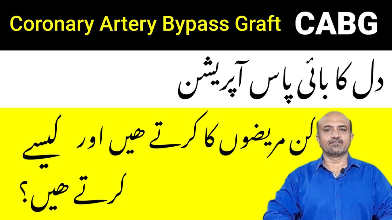 What Is CABG | How Is Coronary Artery Bypass Graft Done | Indications ...