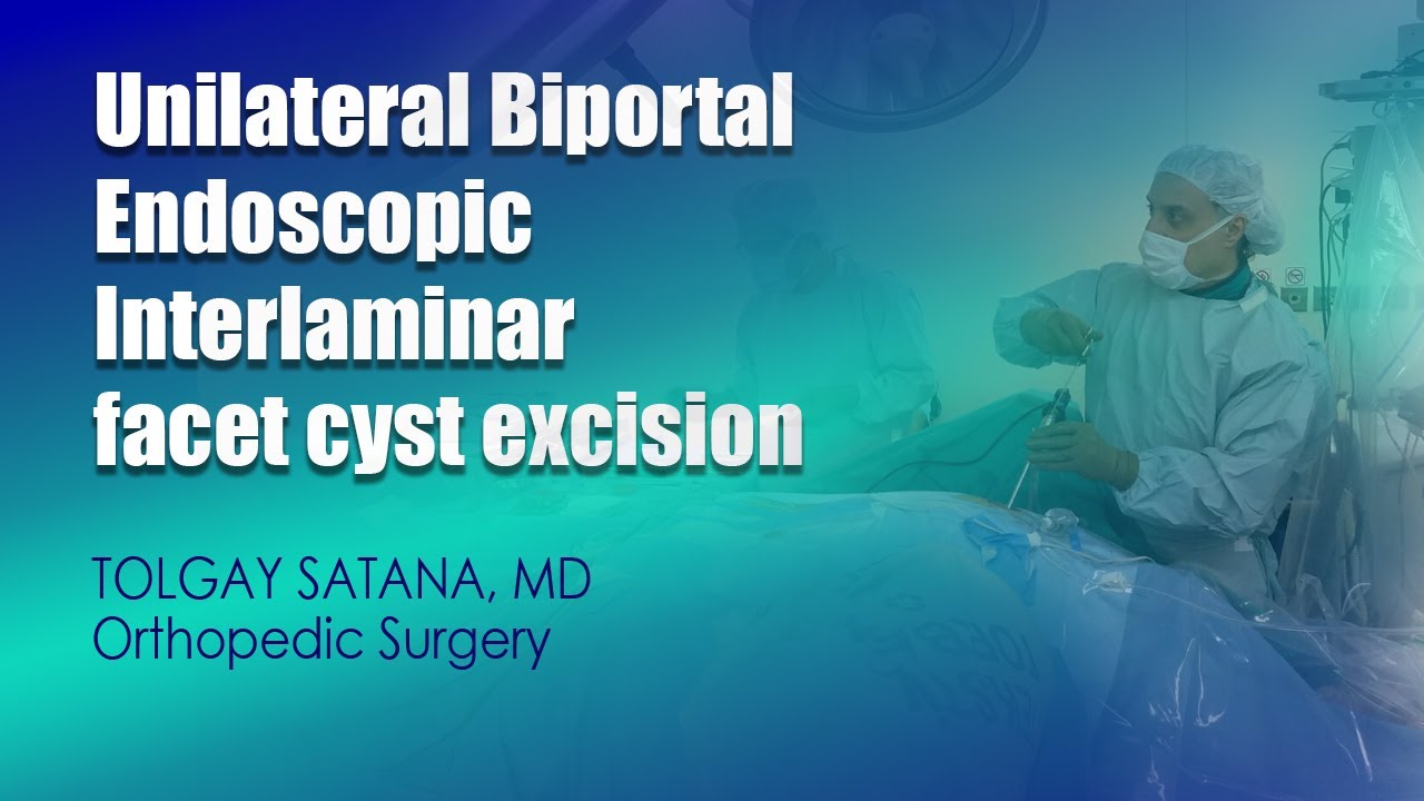 Unilateral Biportal Endoscopic İnterlaminar facet cyst excision - YouTube