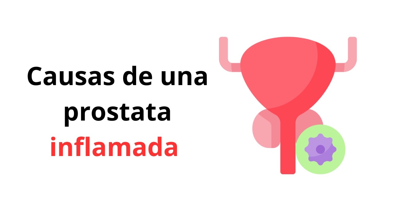 Las Causas De Una Prostata Inflamada - YouTube