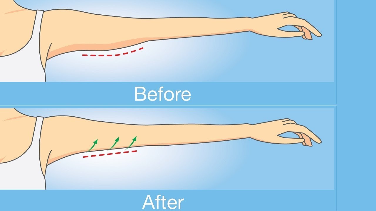 How To Lose Weight On Arms (Reduce Arm Fat in Weeks) - YouTube