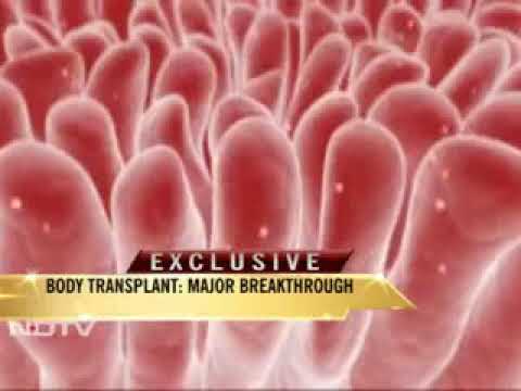 New invention full body transplant ,is in experience you can watch ...