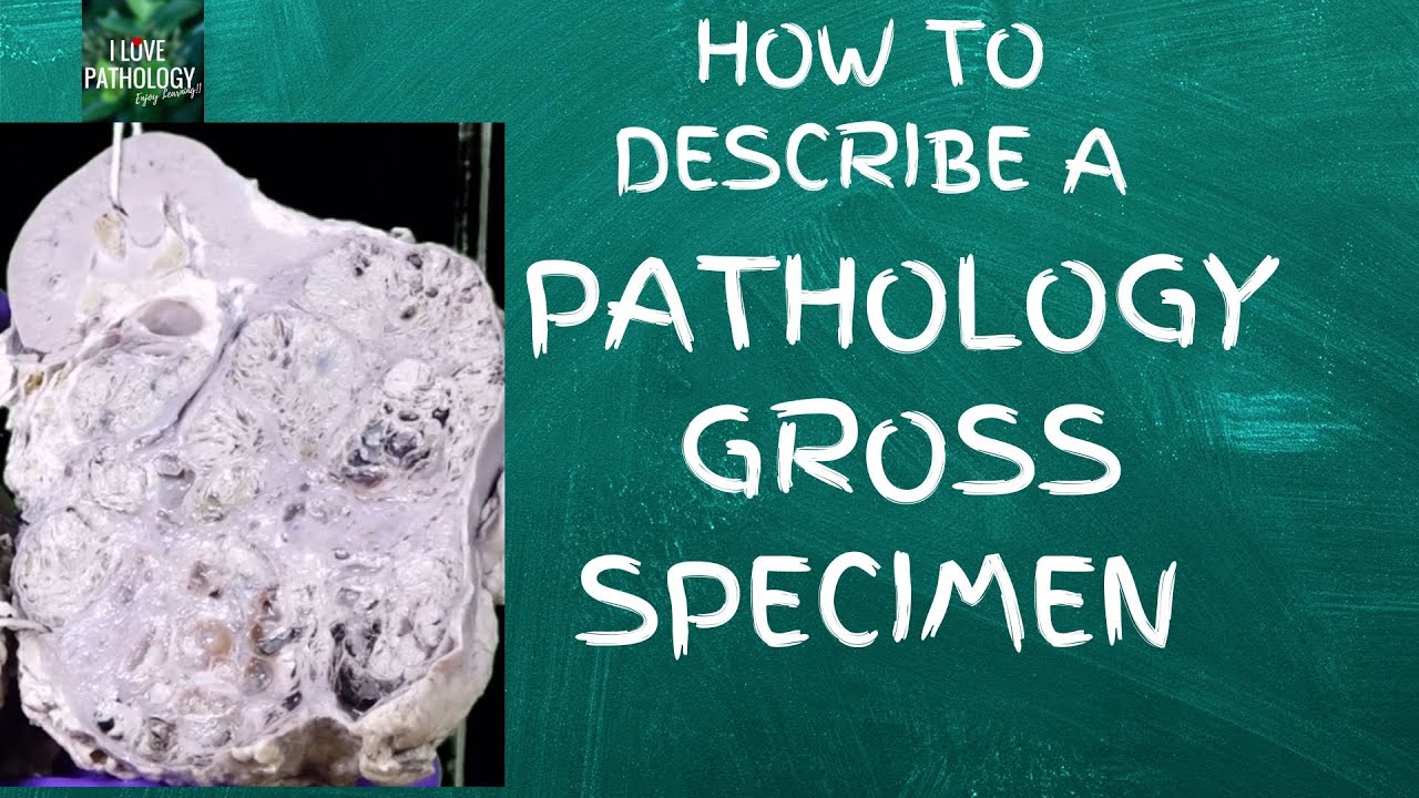 GROSS SPECIMEN DESCRIPTION- Renal cell carcinoma & General Guidelines ...