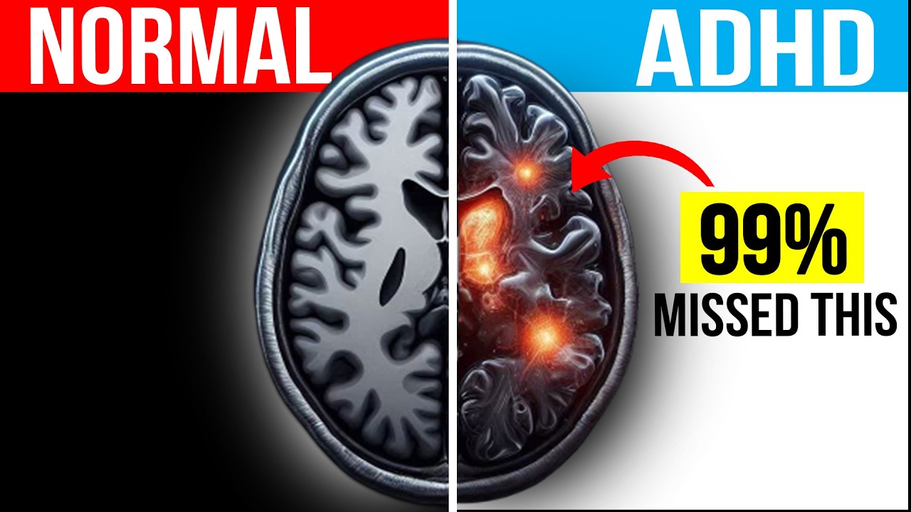 Most Critical ADHD Test Your Doctor Forgot To Do - YouTube