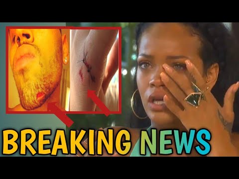 Rihanna in Tears After Asap Rocky INJURED Chris Brown after Mocking ...