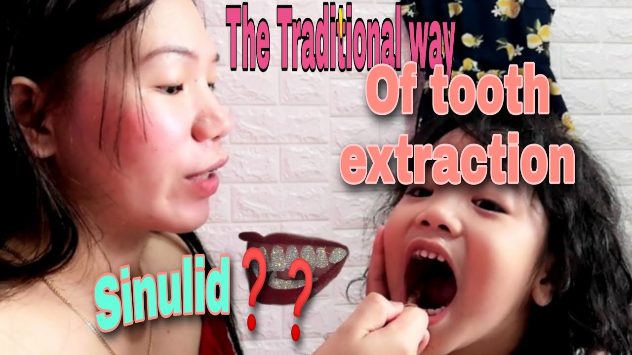 TOOTH EXTRACTION USING THREAD //THE TRADITIONAL WAY Episode 09 - YouTube