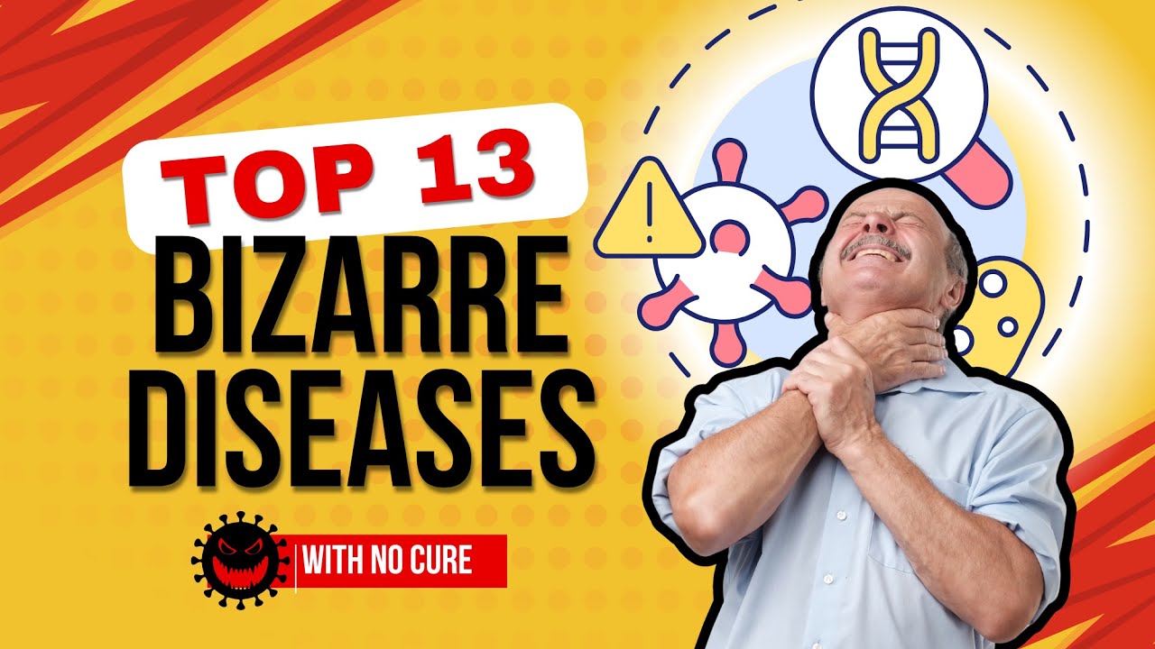 13 Bizarre Diseases That Science Can’t Solve - YouTube